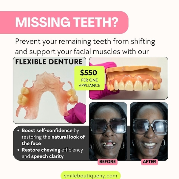 Dental Impression Kit - Etsy