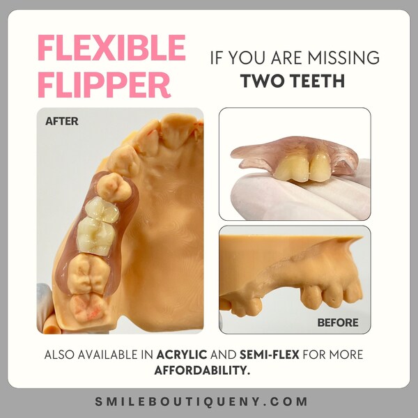 Partial Dentures - Etsy