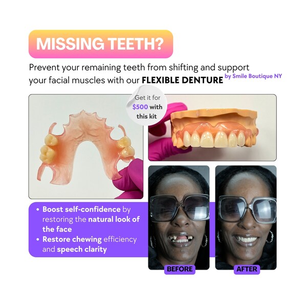 Dental Impression Kit - Etsy