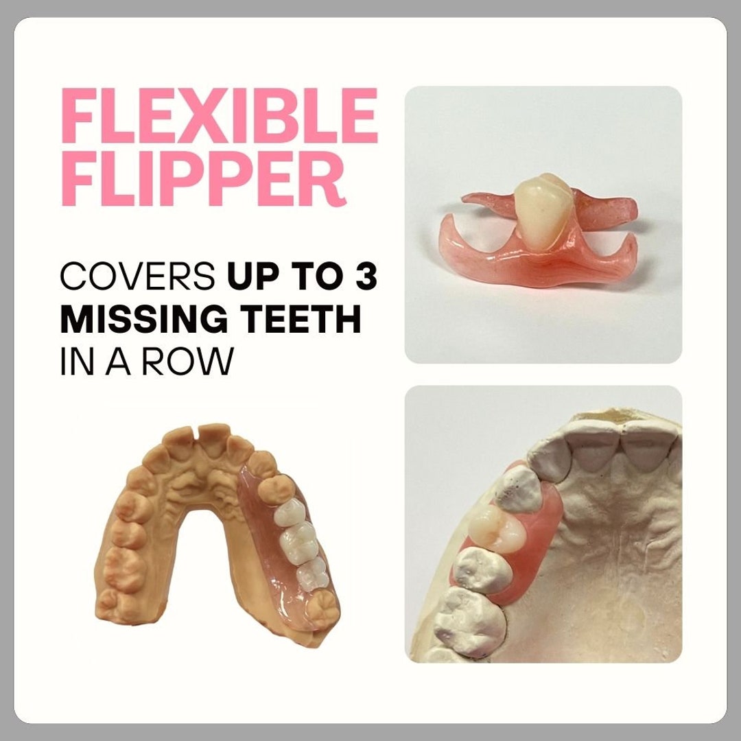 Flexible Flipper. Comfortable Solution for up to 3 Missing Teeth in a ...