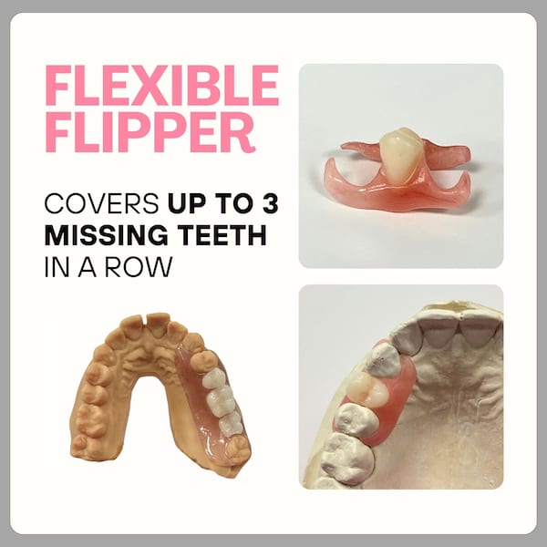 Dental Impression Kit - Etsy