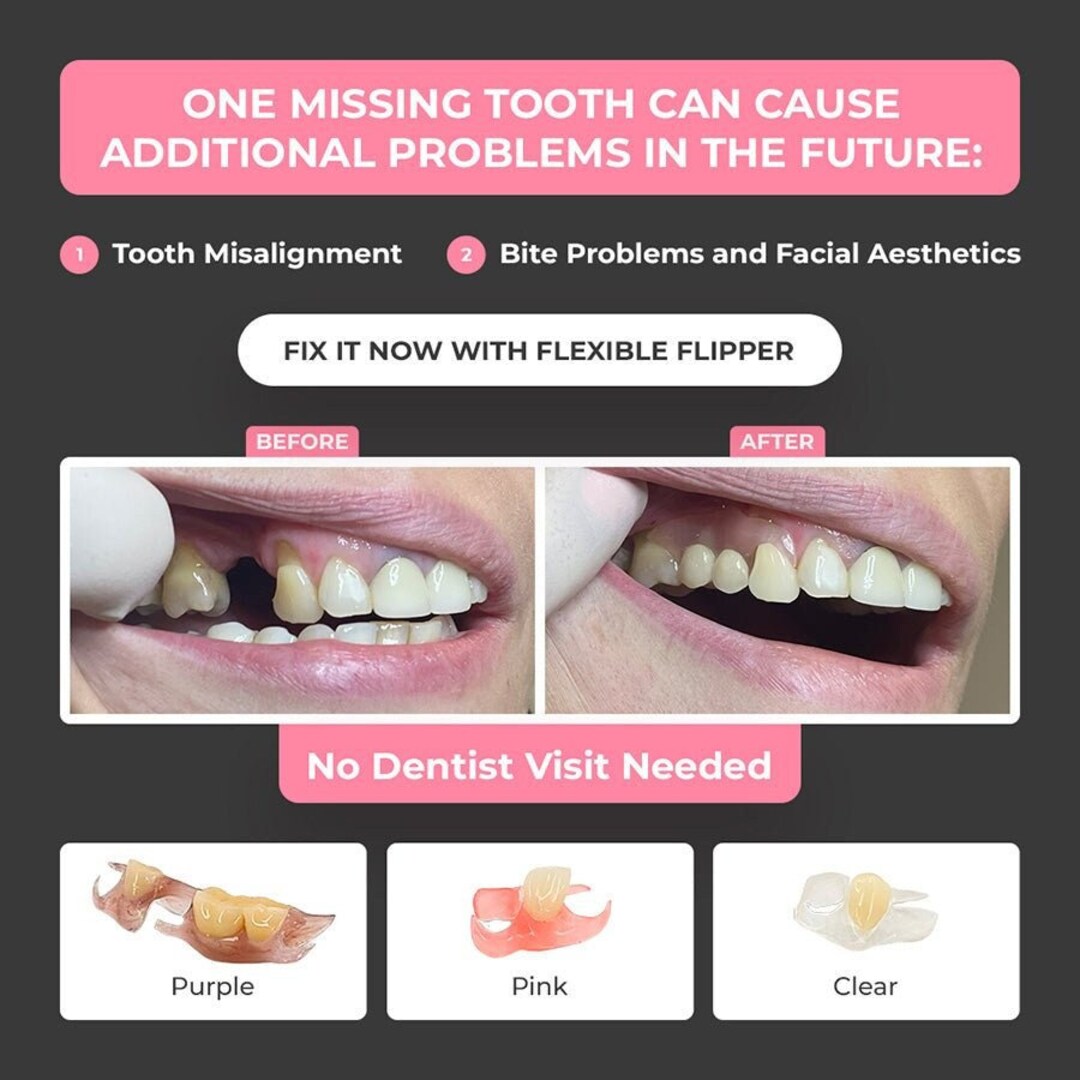 Missing Tooth Fix at Home, Flexible Nesbit No Dentist, Flexible Partial ...
