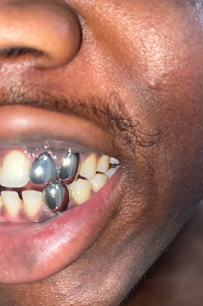 Custom Made to Fit* Antitarnish Dental Gold Tooth Caps *handcrafted* - Etsy