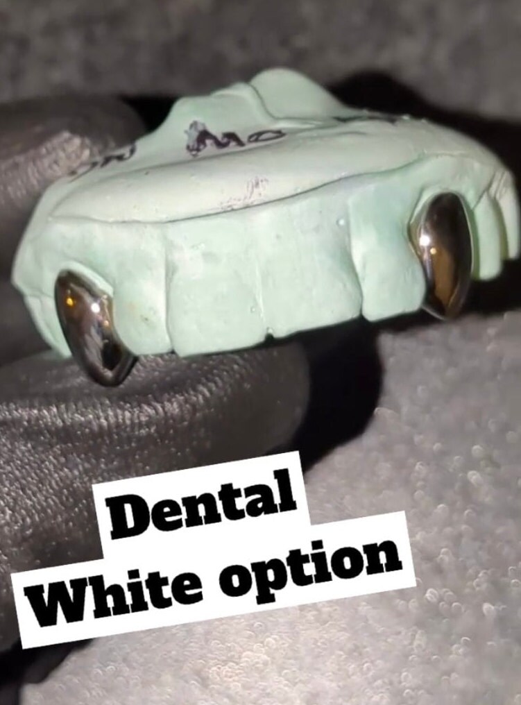 Custom Made to Fit* Antitarnish Dental Gold Tooth Caps *handcrafted* - Etsy