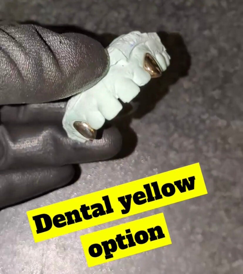 Custom Made to Fit* Antitarnish Dental Gold Tooth Caps *handcrafted* - Etsy
