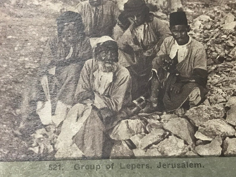 Vintage Historical Rare Photo 1900's Era Group of Lepers From Jerusalem ...