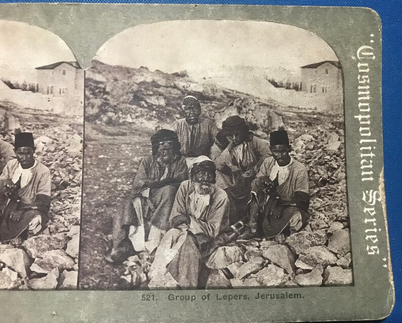 Vintage Historical Rare Photo 1900's Era Group of Lepers From Jerusalem ...