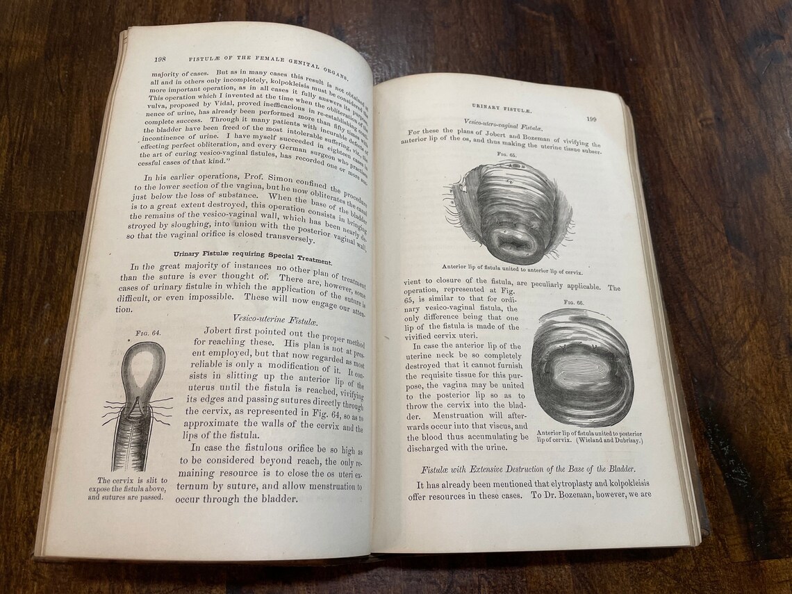 1872 Practical Treatise of the Diseases on Women by T Gaillard Thomas ...