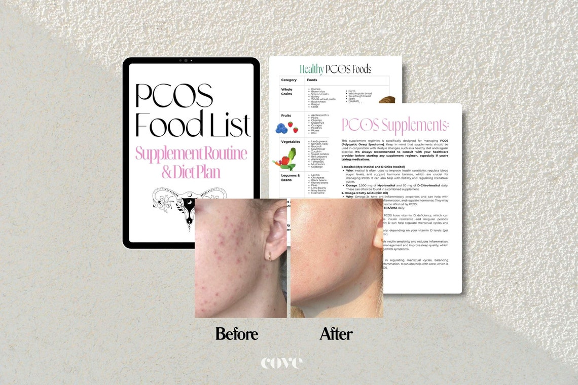 PCOS Food List & Diet Plan for Managing PCOS Weight Loss and Acne | Low ...