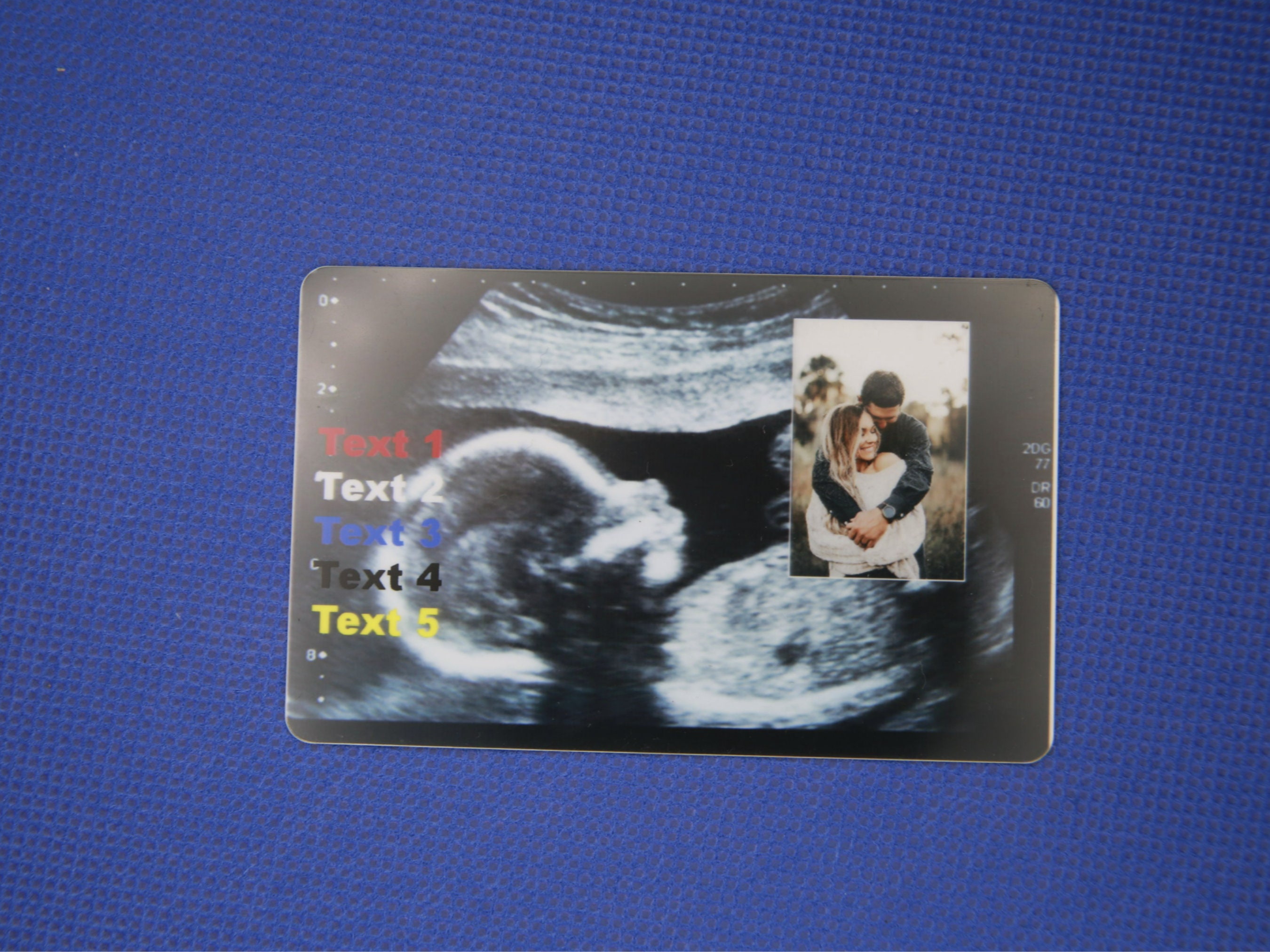 Custom Design Plastic Card Printing - Personalized Business ID Badge ...