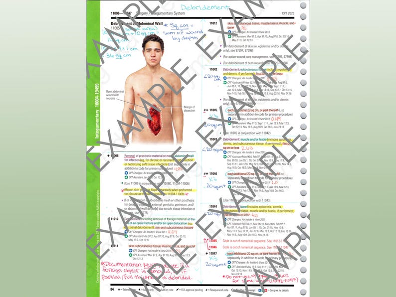 2026 CPT Surgery Integumentary System Book Notes - Etsy