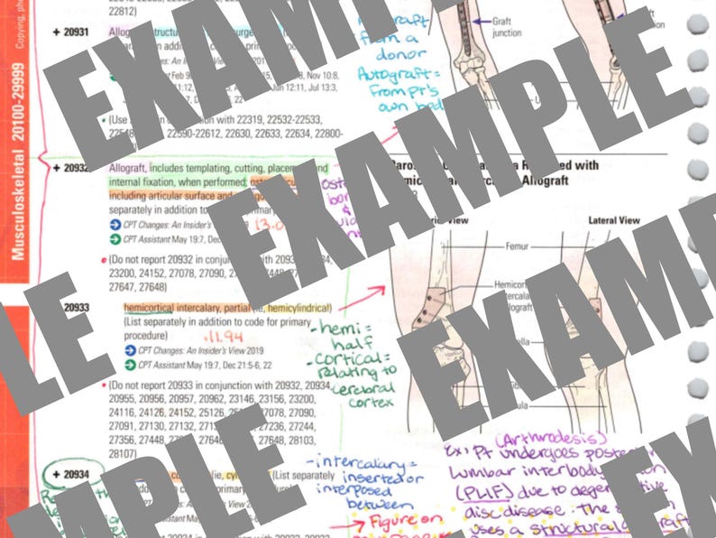 2025 CPT Surgery Musculoskeletal System Book Notes - CPT Guideline ...