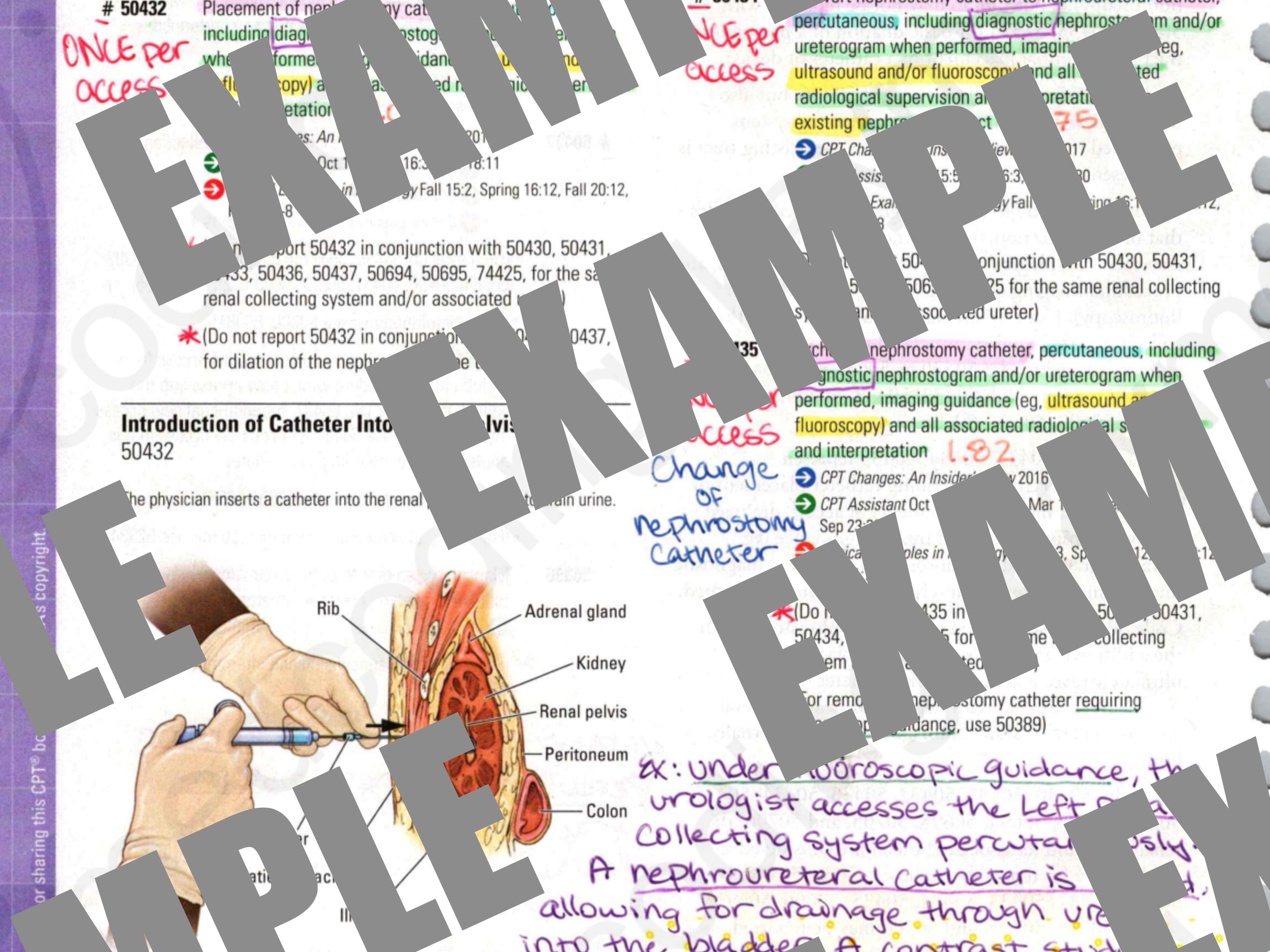 2025 CPT Surgery Urinary System Book Notes - Etsy