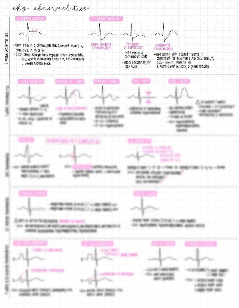 Medical Surgical Nursing II: EKG Basics and Interpretation ...