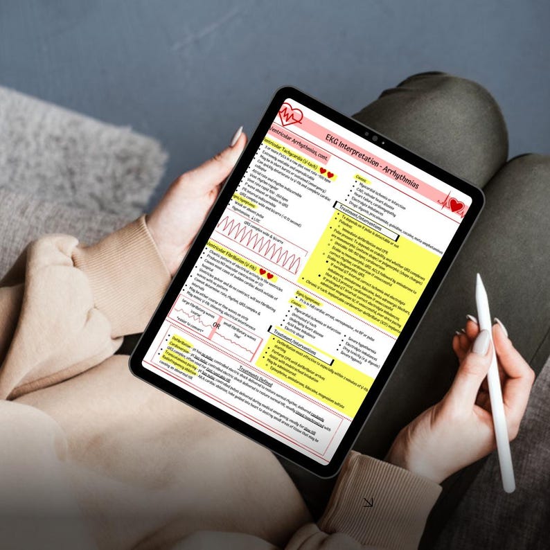 EKG Interpretation Nursing Notes | ECG Rhythm Analysis Study Guide ...