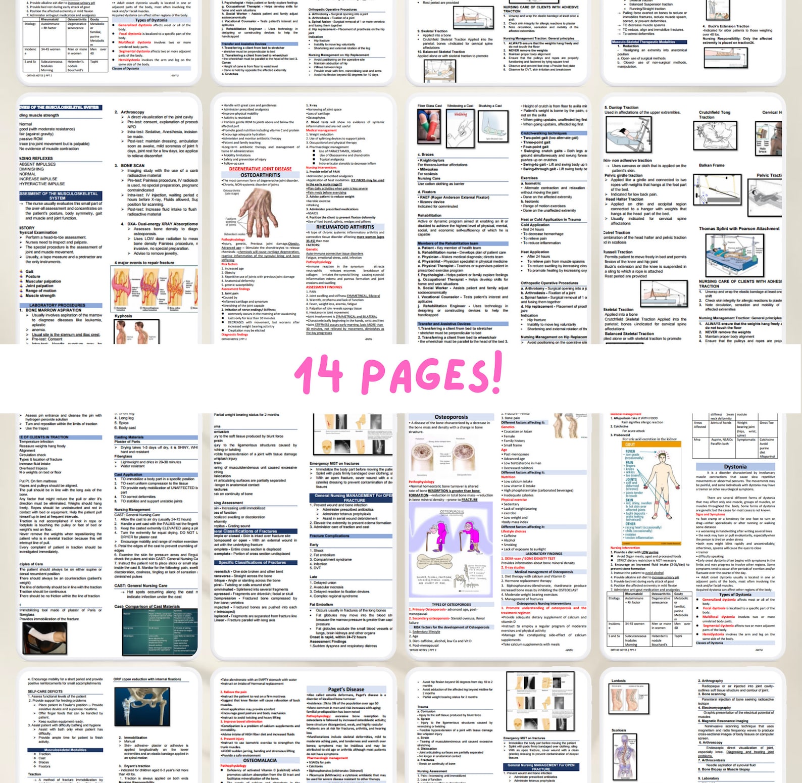 Orthopedic Nursing Notes | Medical-surgical Study Guide for Nursing ...