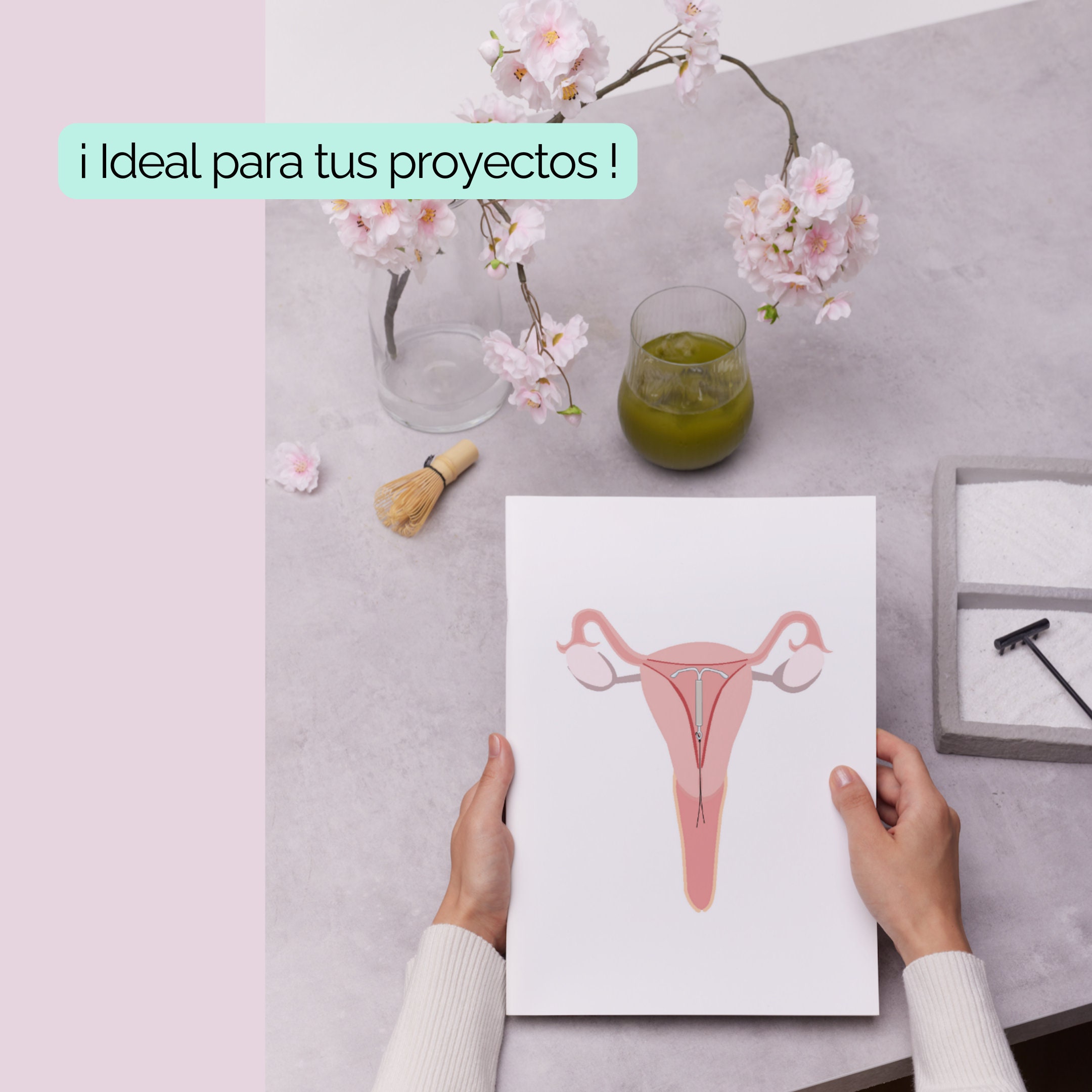 Images Schemes of Contraceptive Methods, Obstetrics and Gynecology ...