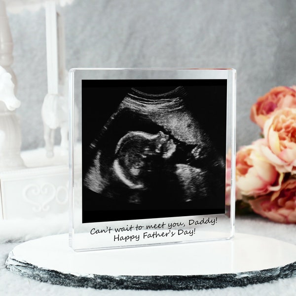 Ultrasound Gifts - 60+ Gift Ideas for 2024