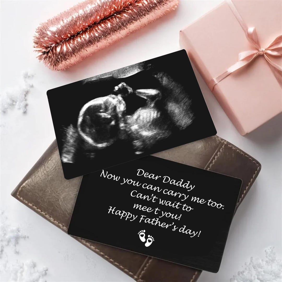 Custom Ultrasound Photo Wallet Card, New Baby Sonogram Gift, Wallet ...