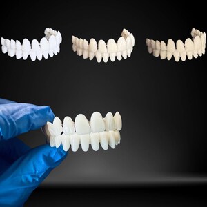 Learn Model Kit, Students, Premium Dental DIY Kit, Denture Kit ...