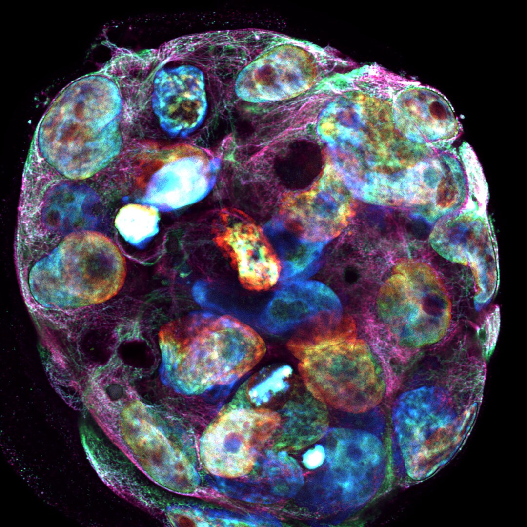 Cellular Microcosm, Cell-art, Cancer, Cell, Biology, Microscope ...