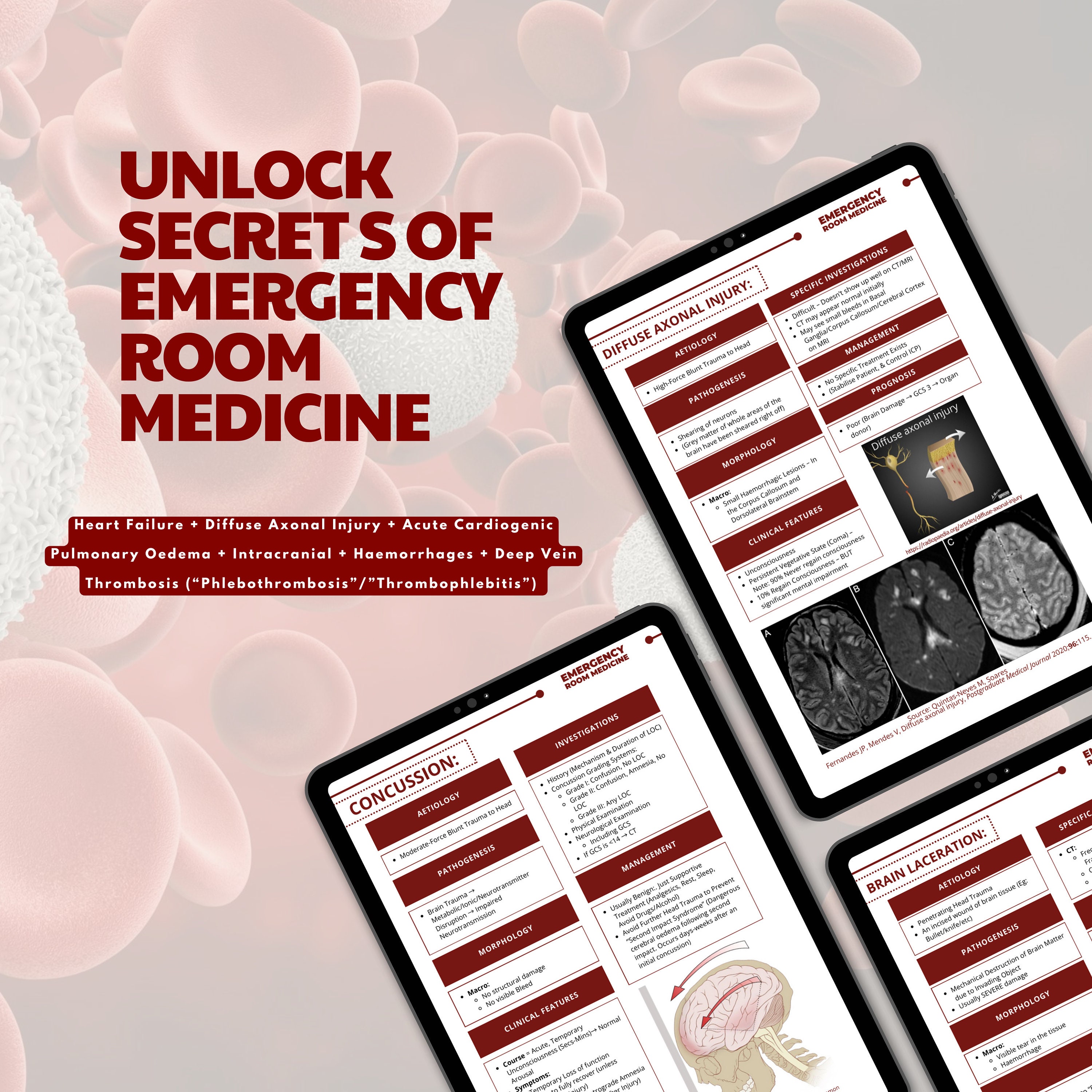 Emergency Room Medicine Bundle With Flashcards and Stickers, Emergency ...