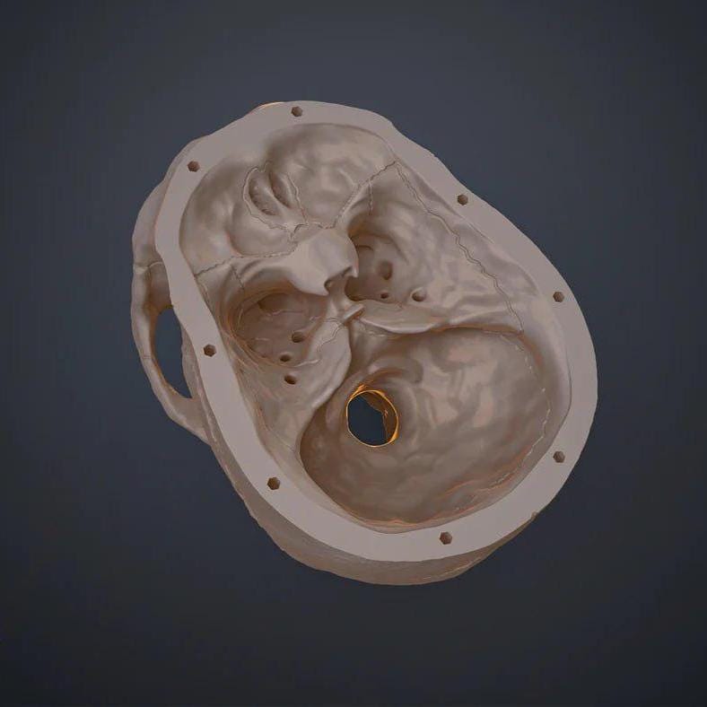 3D Skull Model: STL File for 3D Printers (digital Download) - Etsy