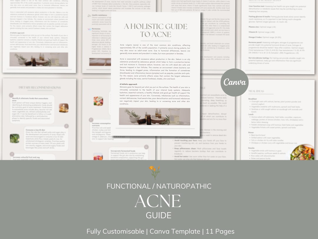 Holistic Acne Guide | Patient Handout | Editable | Canva Template | for ...