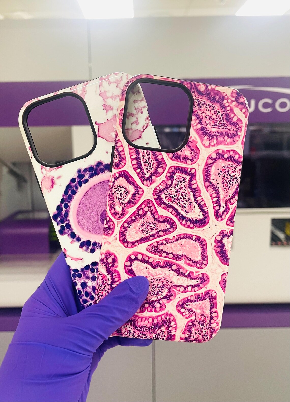 Histology Art, Intestine Design iPhone Case for iPhone 16, iPhone 15 ...