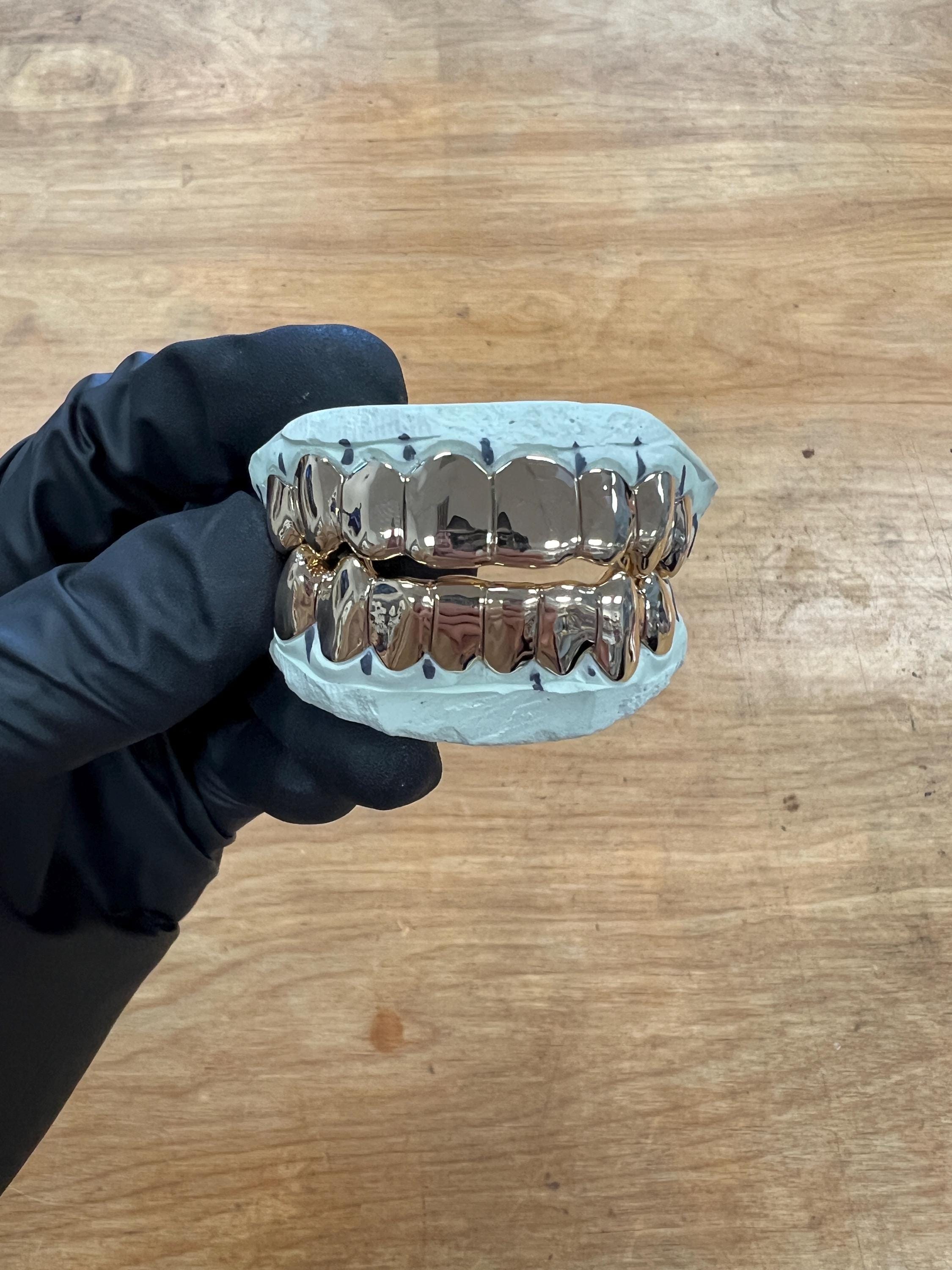 Custom Solid GOLD Grillz 10k 14k 925 Silver Grills - Etsy