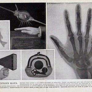 Xray Invention Roentgen Ray Machine 1911 Science Rotogravure to Frame ...