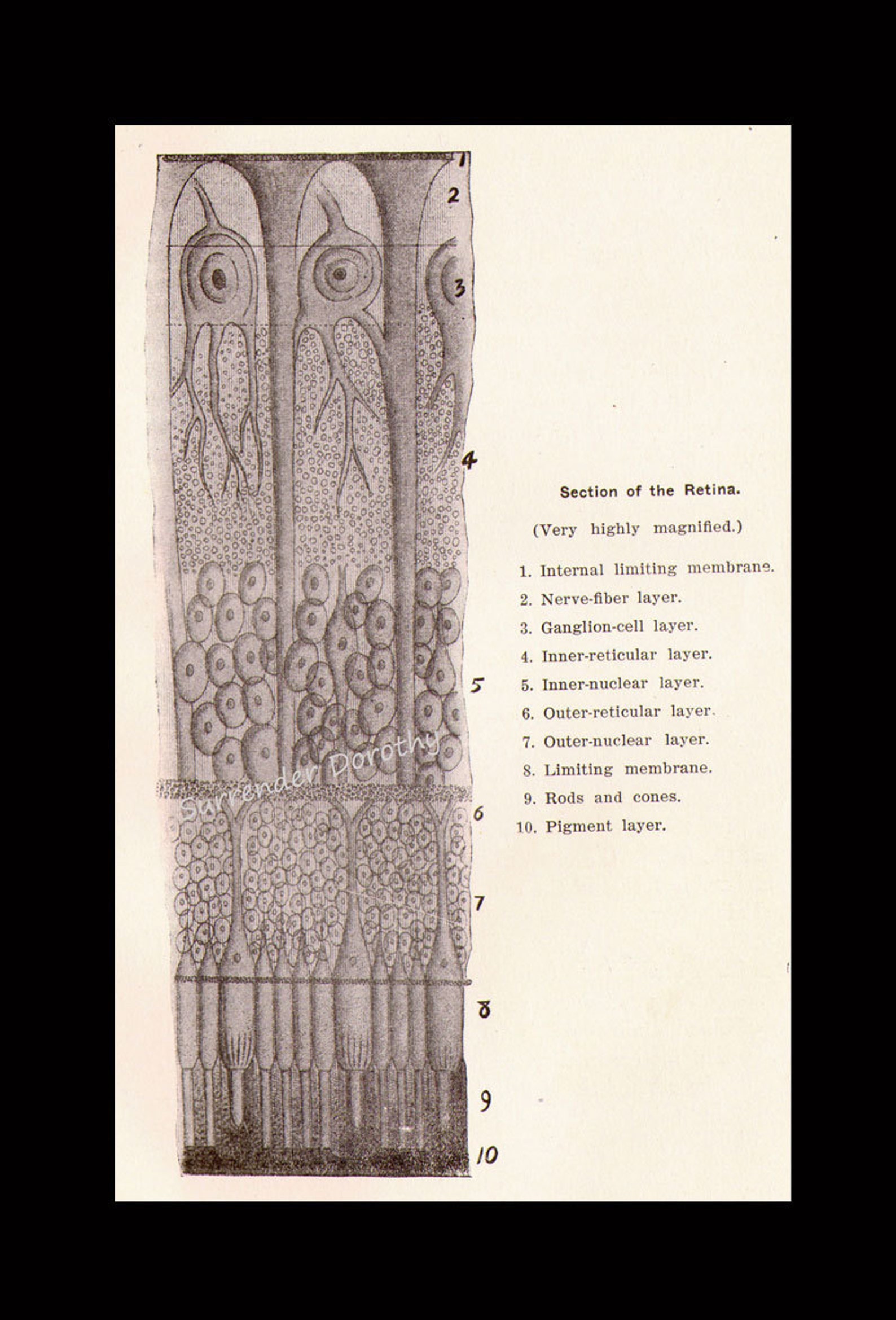 Retina Cross Section Human Eye Anatomy Chart 1920s Medical Illustration ...