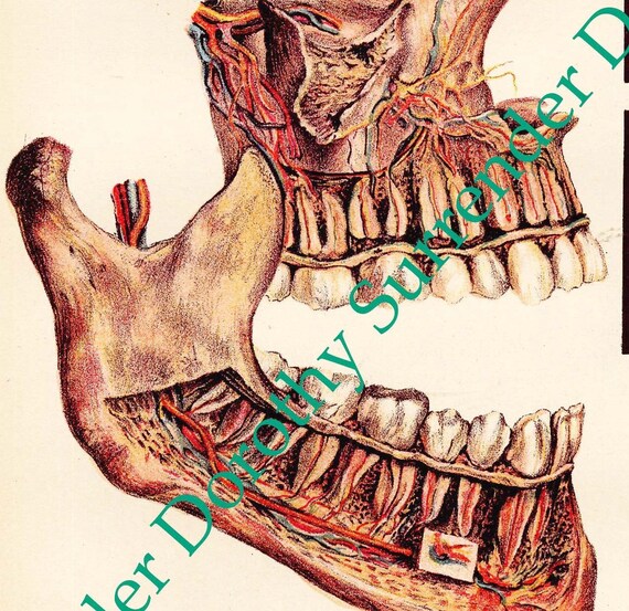 Human Anatomy Tooth Disease Creepy Tooth Fairy 1908 Medical | Etsy