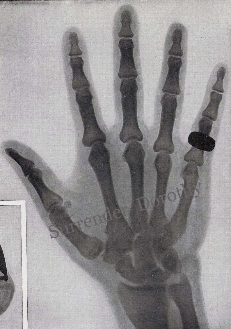 Xray Invention Roentgen Ray Machine 1911 Science Rotogravure to Frame ...