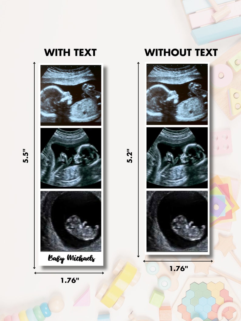 Ultrasound Photo Booth Strip Print | Photo Gift | Custom Photo Fridge ...