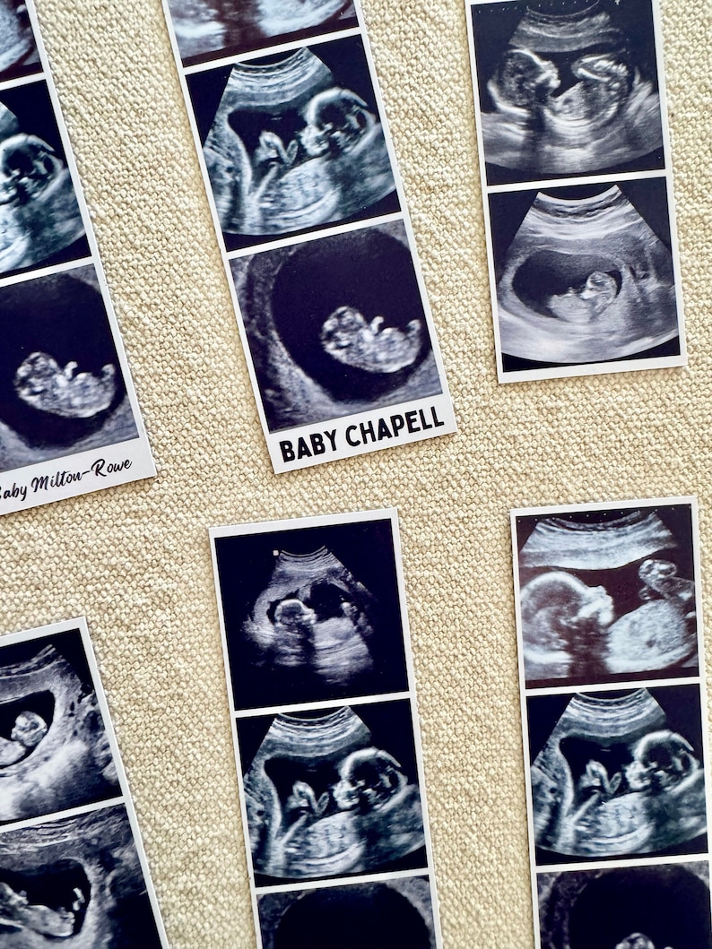 Ultrasound Photo Booth Strip Print | Photo Gift | Custom Photo Fridge ...