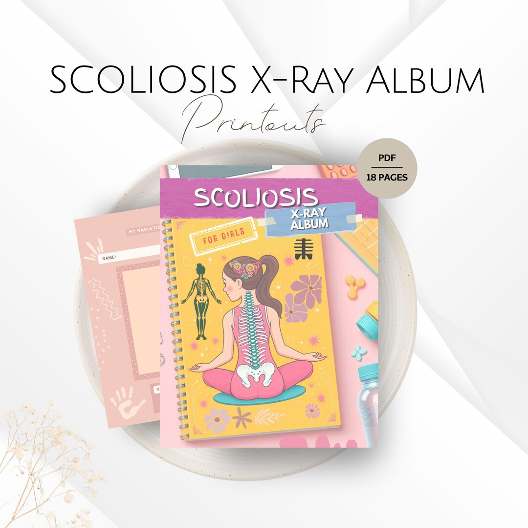 Scoliosis X-rays Tracker Templates, Printable Spinal Radiation Tracking ...