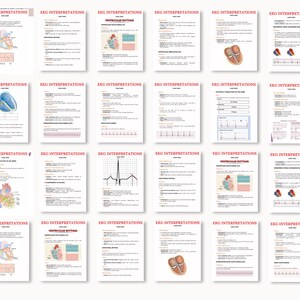 EKG Rhythm Interpretation Study Guide: Nursing Cheat Sheet (digital ...