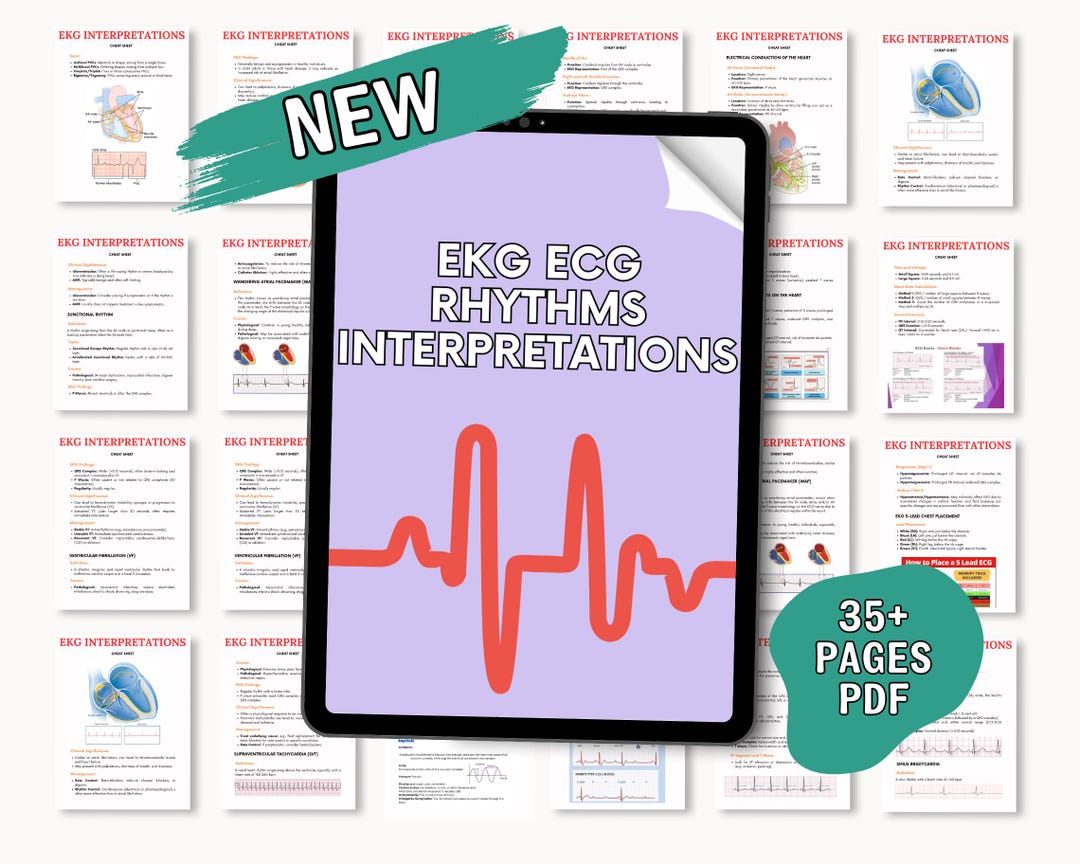 EKG Rhythm Interpretation Study Guide: Nursing Cheat Sheet (digital ...
