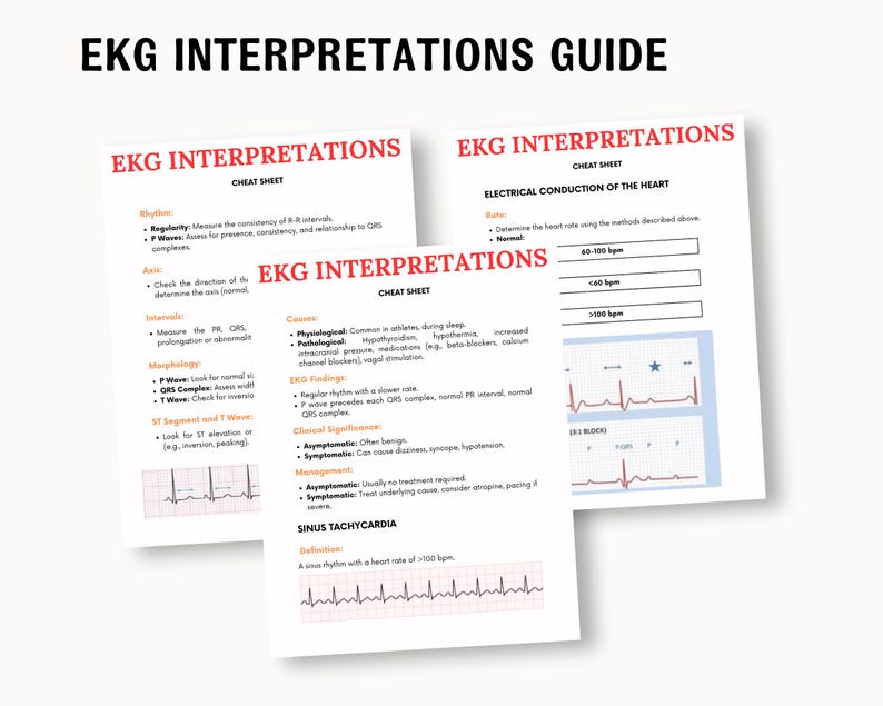 EKG Rhythm Interpretation Study Guide: Nursing Cheat Sheet (digital Download) - Etsy