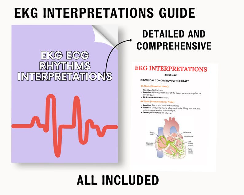 EKG Rhythm Interpretation Study Guide: Nursing Cheat Sheet (digital Download) - Etsy