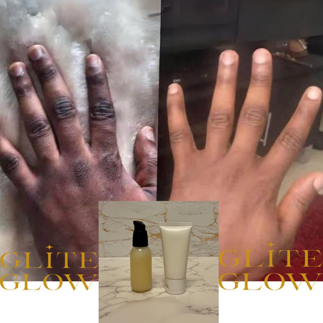 Dark Knuckles Corrector Dark Hands Dark Feet - Etsy