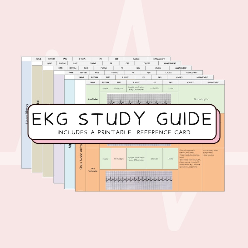 EKG Study Guide for Nursing Student Nursing Note for New Grad Nurse EKG ...