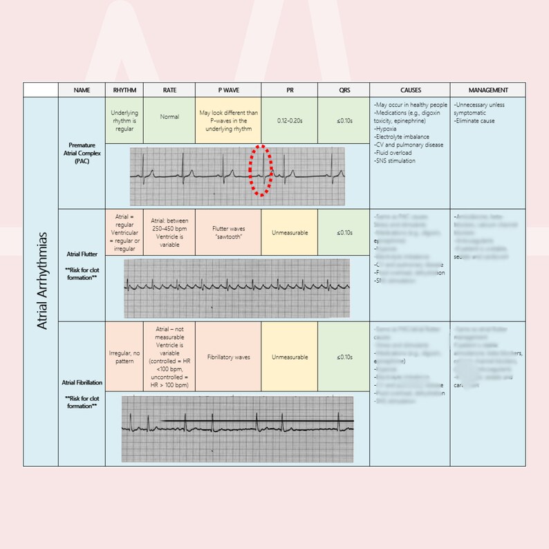 EKG Study Guide for Nursing Student Nursing Note for New Grad Nurse EKG ...