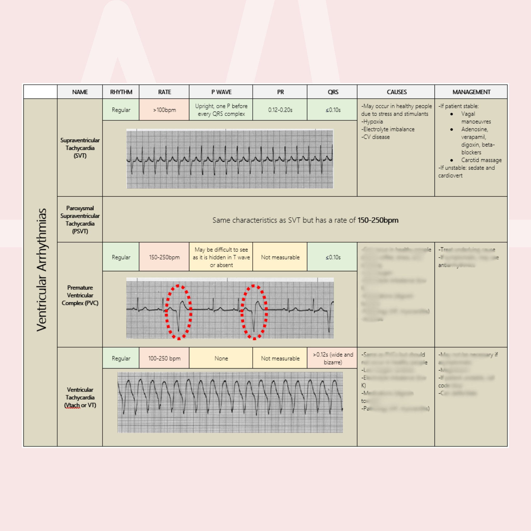 EKG Study Guide for Nursing Student Nursing Note for New Grad Nurse EKG ...