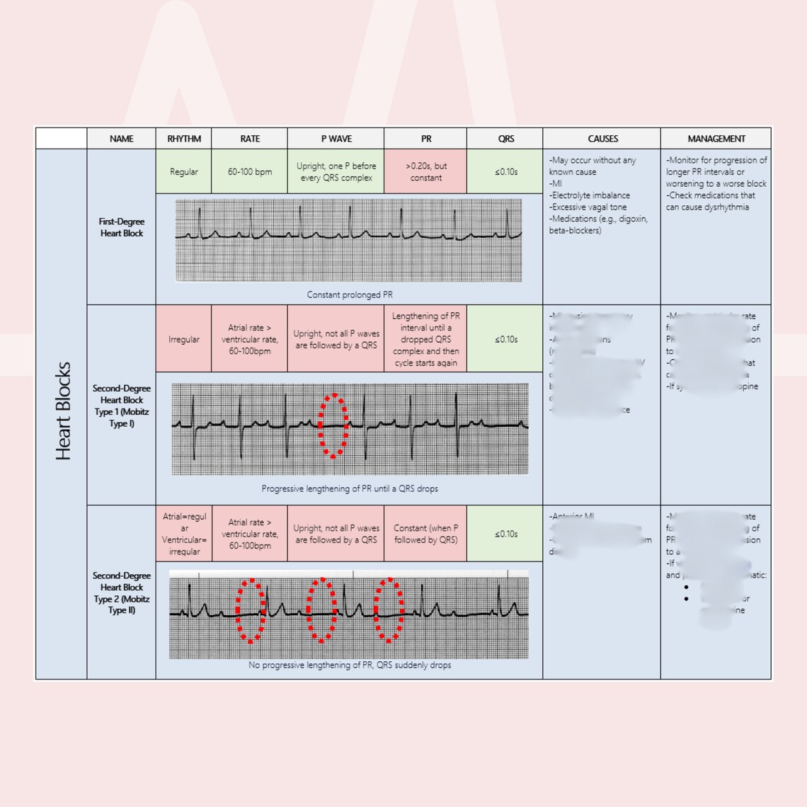 EKG Study Guide for Nursing Student Nursing Note for New Grad Nurse EKG ...
