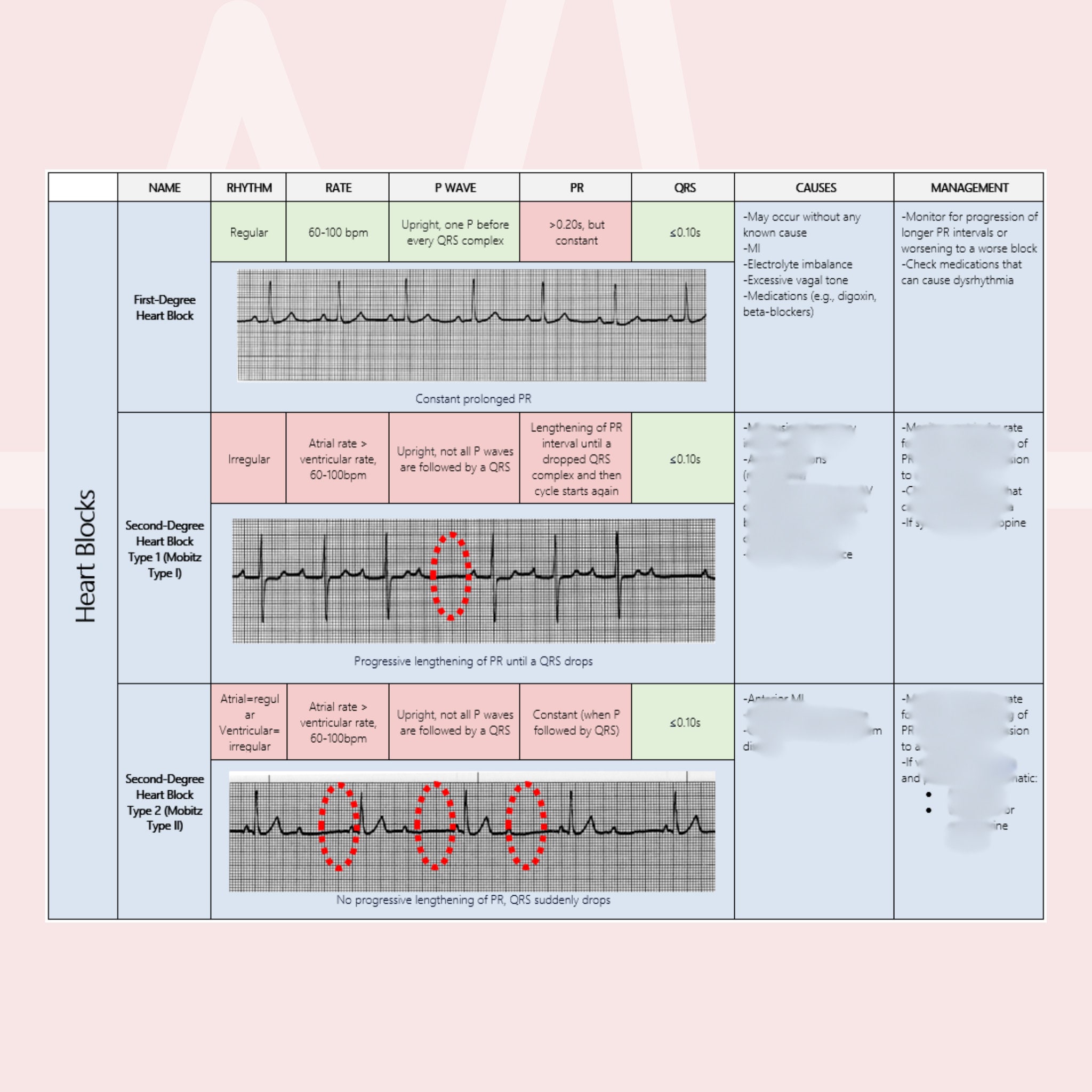 EKG Study Guide for Nursing Student Nursing Note for New Grad Nurse EKG ...