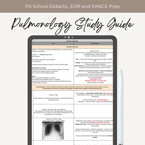 Pulmonology Study Guide: PA School Didactic EOR & PANCE Review / Chart ...