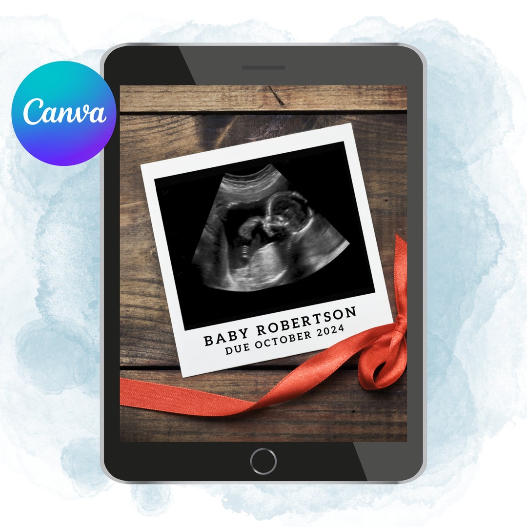 Custom Baby Scan Pregnancy Digital Announcement | Social Media Template ...