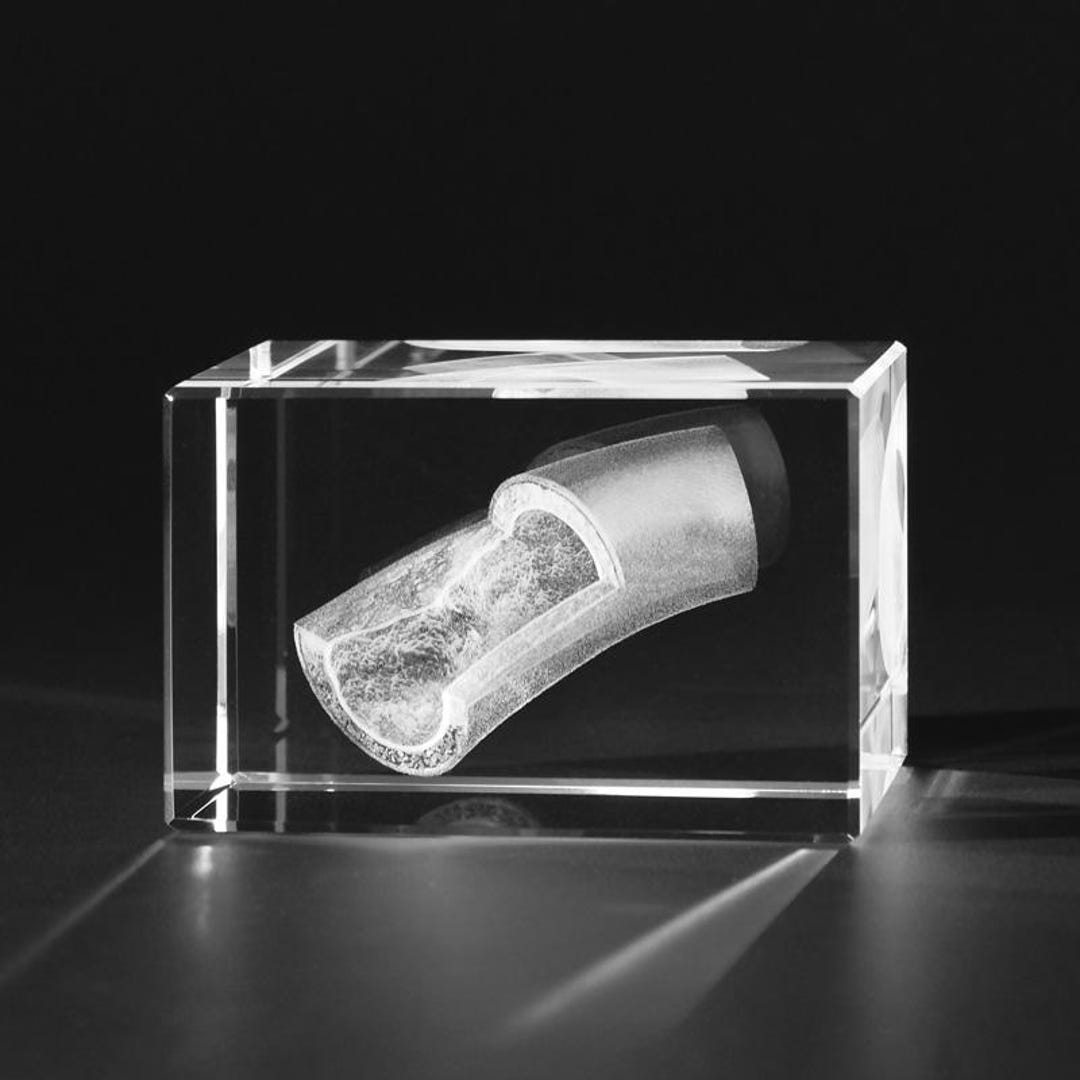 3D Anatomy in Crystal - Original 3D Crystal - Medical Model - Internal ...